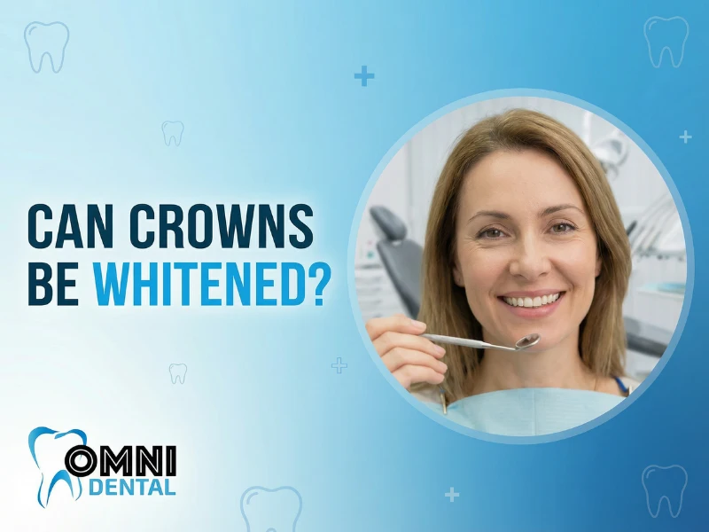Can Crowns Be Whitened? - Omni Dental & Medspa | Arlington Heights,IL