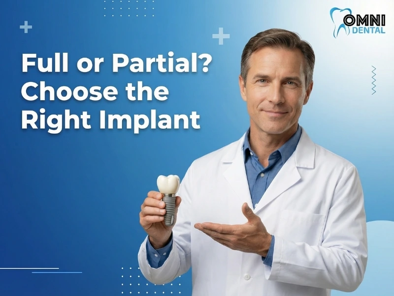Full vs. Partial Dental Implants Explained- Omni Dental Of Arlington ...